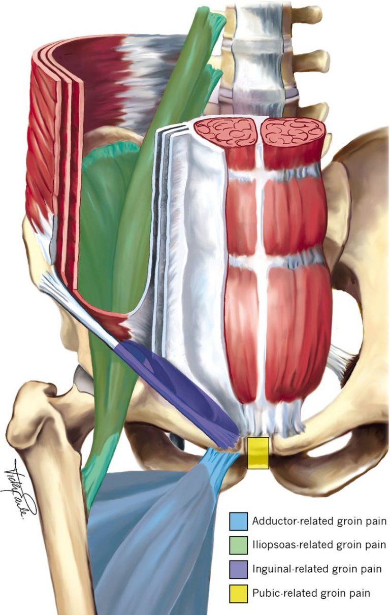 Hip And Groin Pain In Sport Physiotherapist Lucas Hoare Mallee Physio Hip And Groin Pain In Sport Physiotherapist Lucas Hoare Mallee Physio